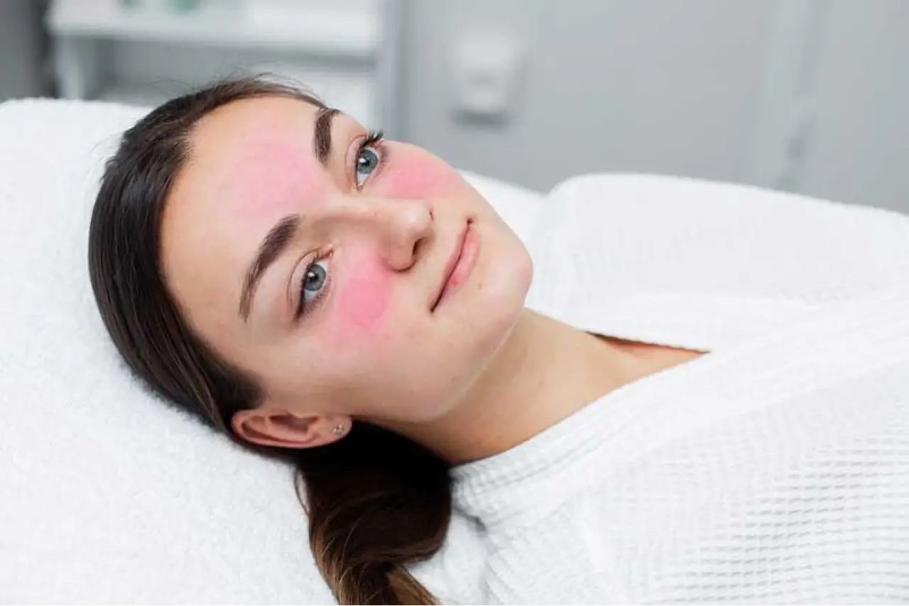 Asinsvadu Ārstēšana ar ND YAG Lāzeru Deka Again Pro - VIVIDERM